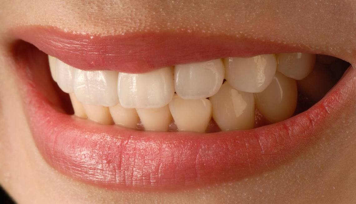 Ecco come rimuovere il tartaro dai denti: un trucco casalingo davvero ... Ecco come rimuovere il tartaro dai denti: un trucco casalingo davvero ...
